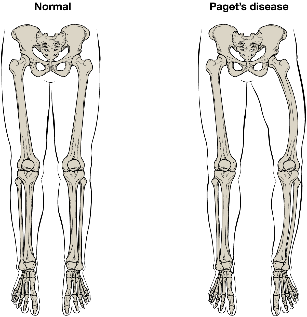 This Illustration Shows The Normal Skeletal Structure Of The Legs From This Illustration Shows The Normal Skeletal Structure Of The Legs From